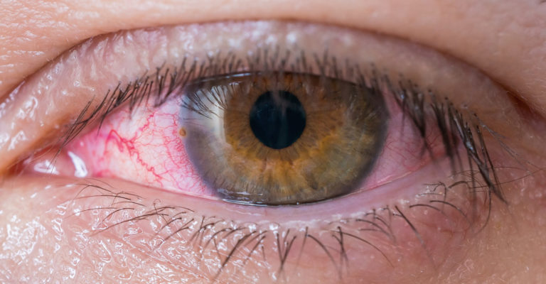 Augenheilkunde und Optometrie Archive | medonline