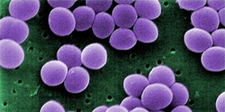 MRSA: Der Keim lauert häufig in den Leisten