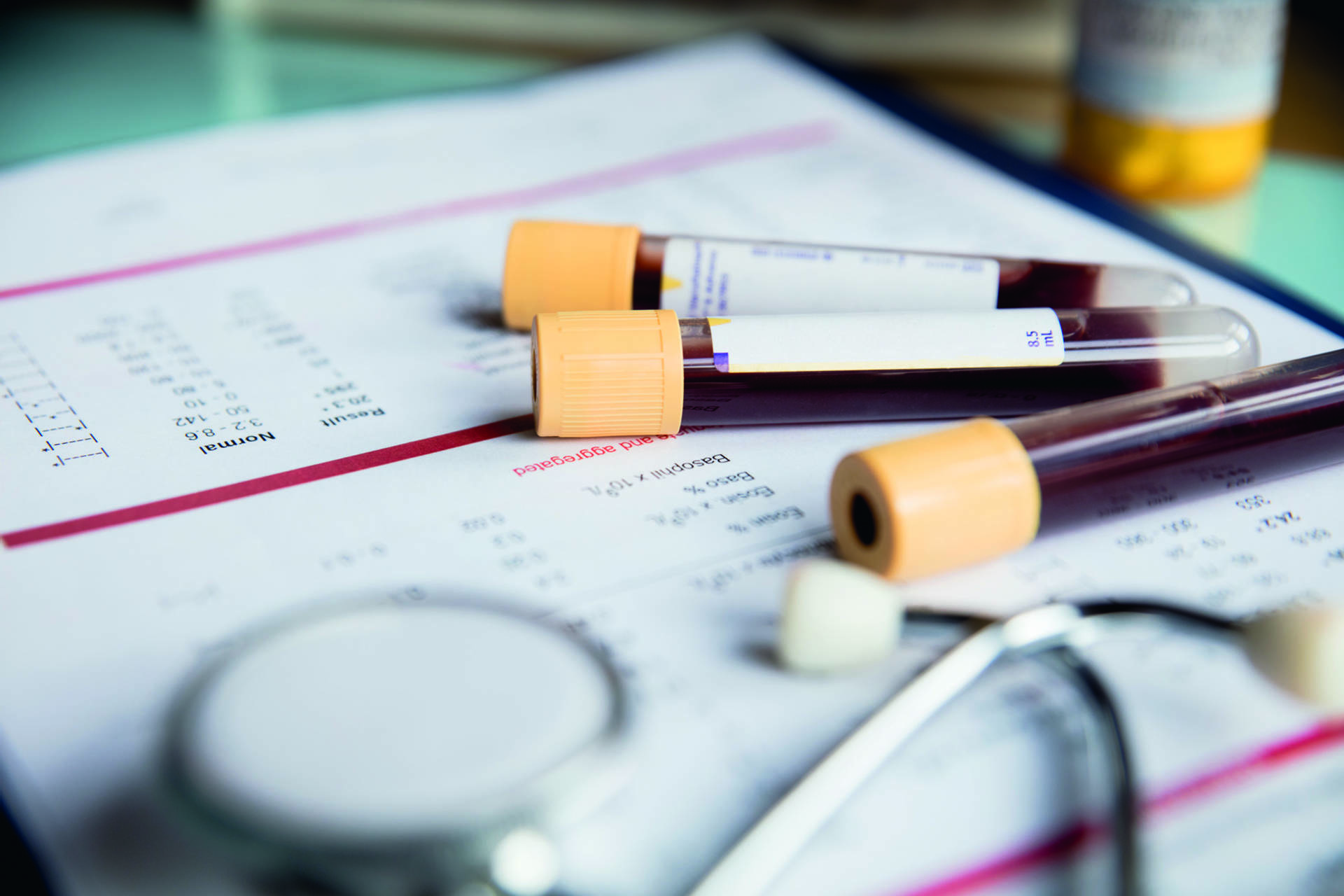 Auf Welche Komplikationen Sie Bei Patienten Mit Sichelzellan mie Achten auf-welche-komplikationen-sie-bei-patienten-mit-sichelzellan-mie-achten