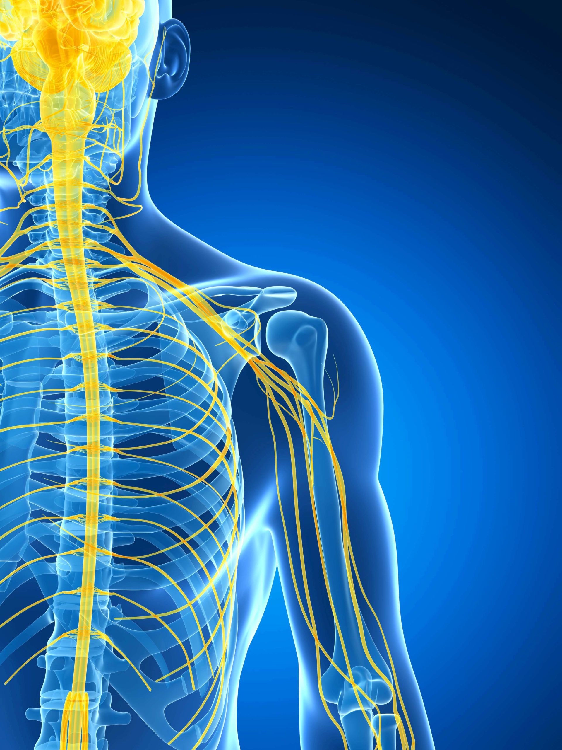 Was man über das Thoracic-Outlet-Syndrom wissen sollte