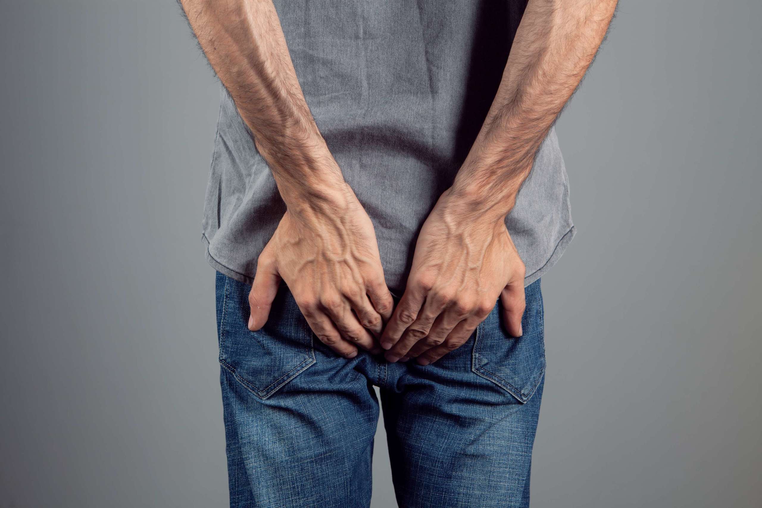 Perianale Dermatosen sind eine Herausforderung