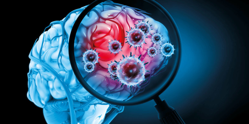 CliniCum neuropsy Archive - medonline