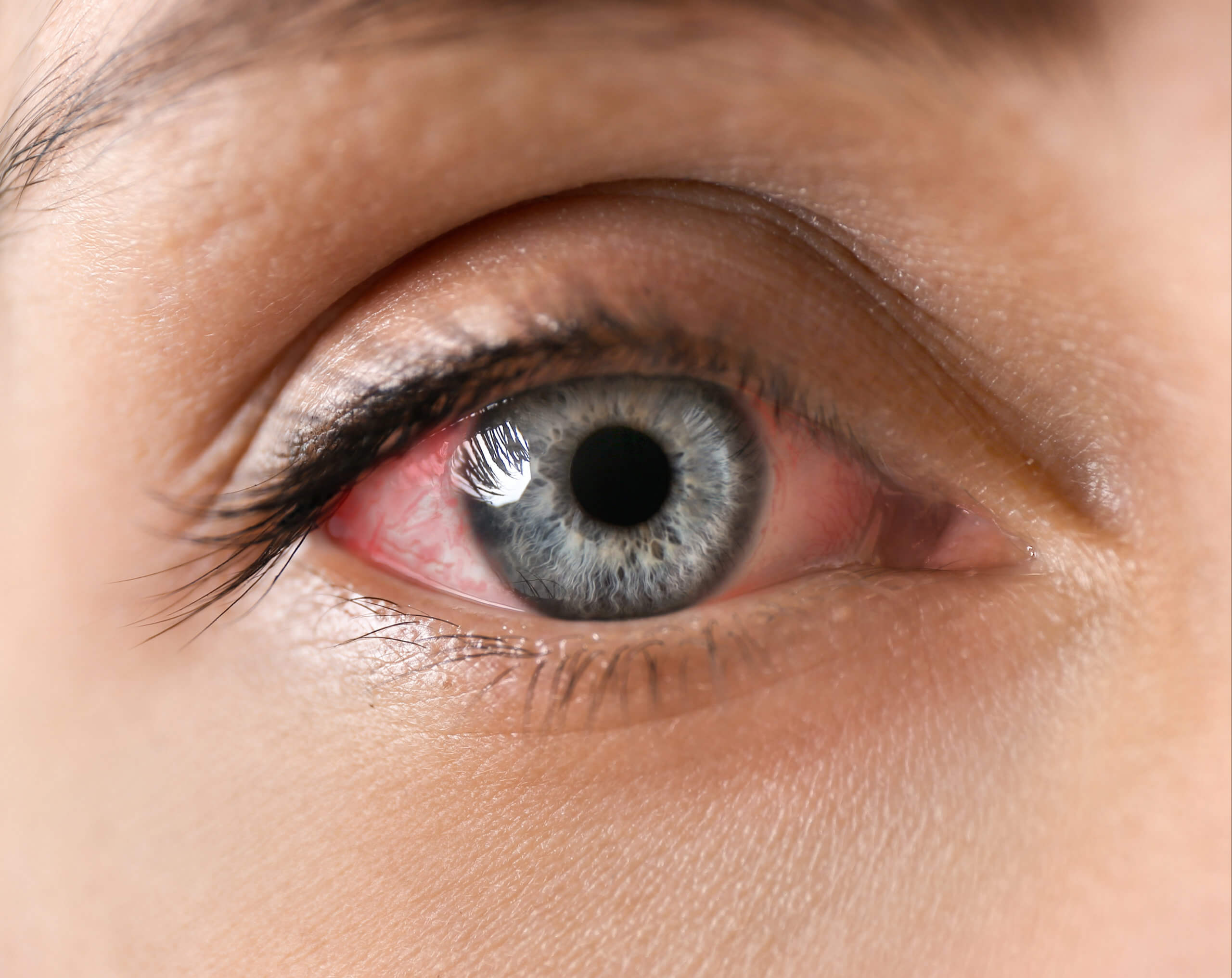 Ursachenforschung bei Uveitis