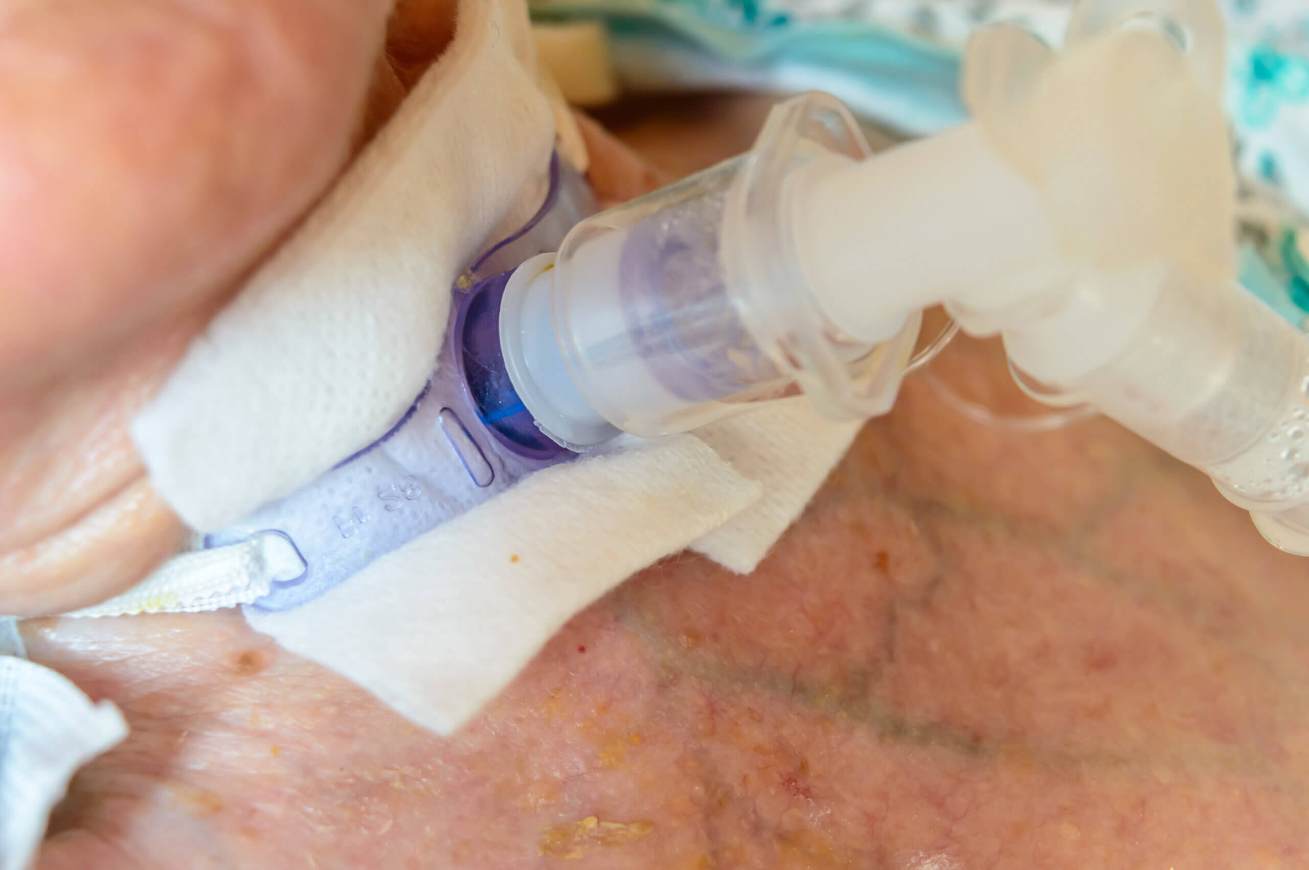 Symptoma.com Patientenfall: Erweitertes Anwendungsgebiet