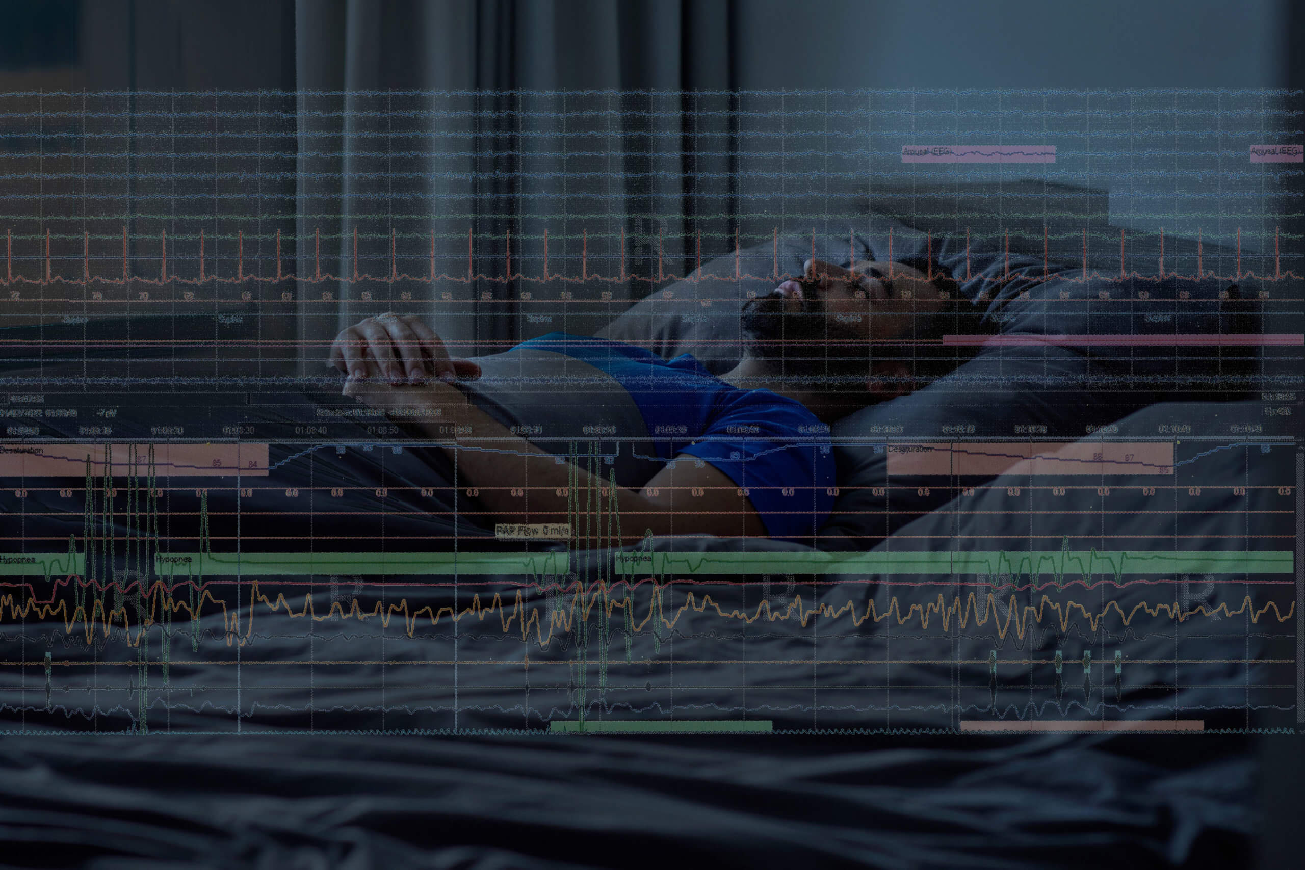 ERS 2023: Der AHI hat bei Schlafapnoe wohl bald ausgedient