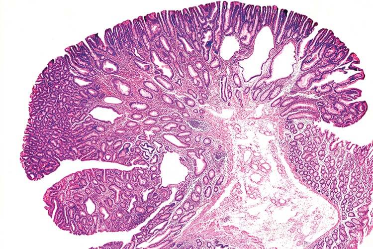 Un vaste éventail de formes