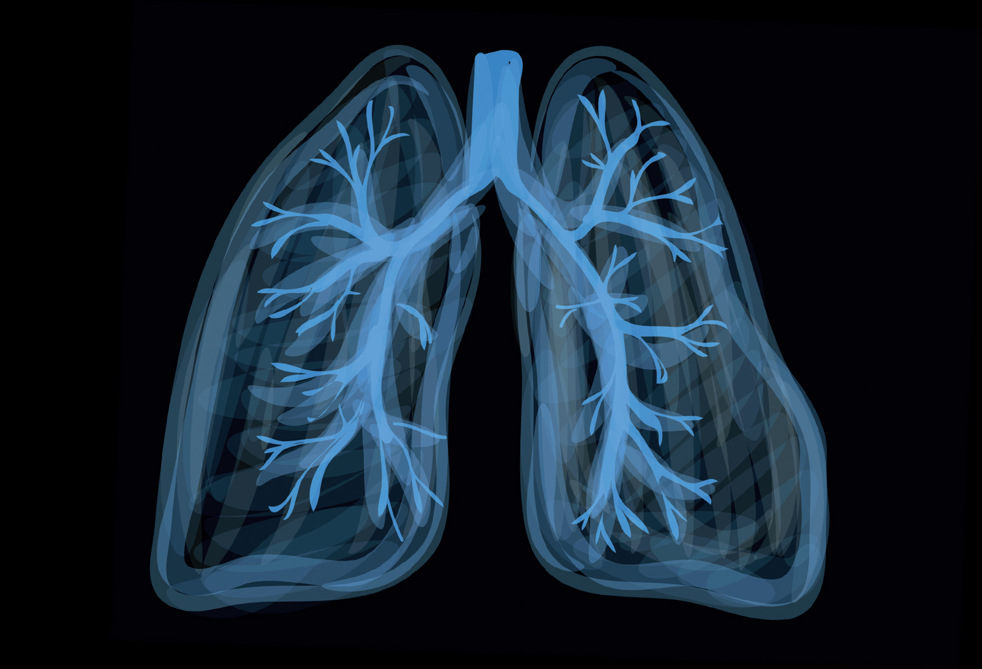 Pneumo Update 2017, Berlin